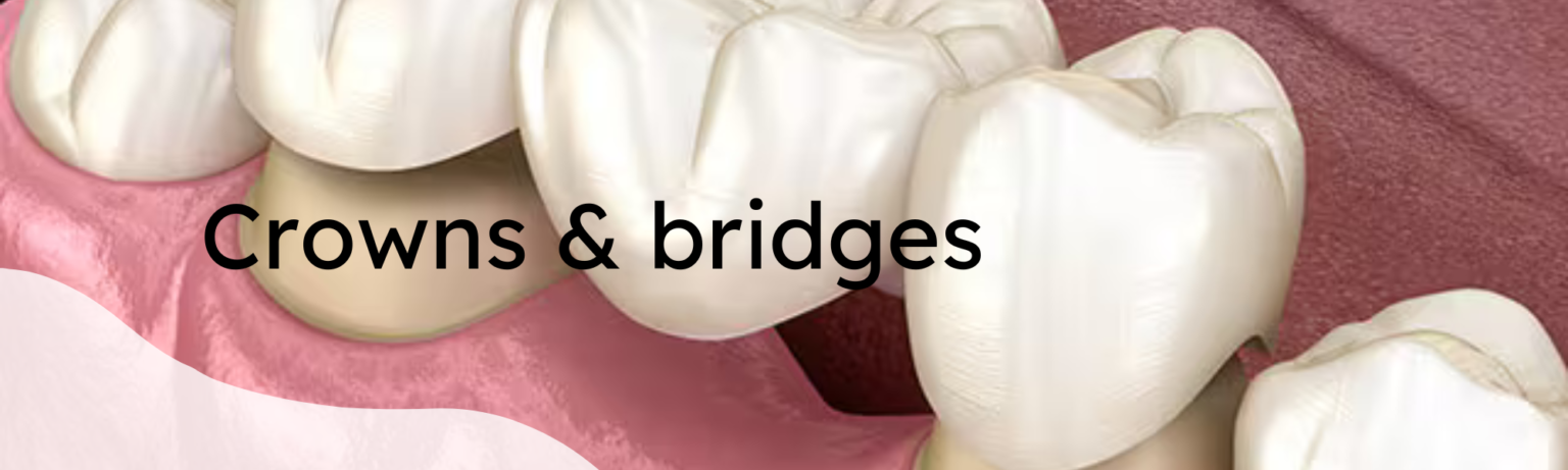 Crowns and bridges – Cosmodent