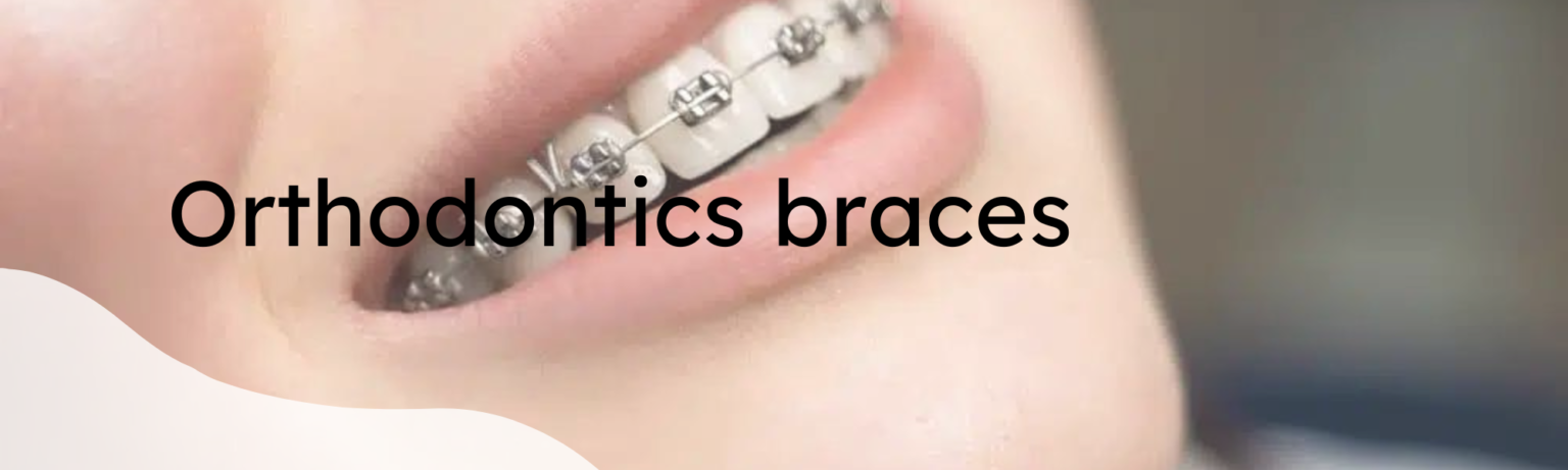 Orthodontics braces – Cosmodent