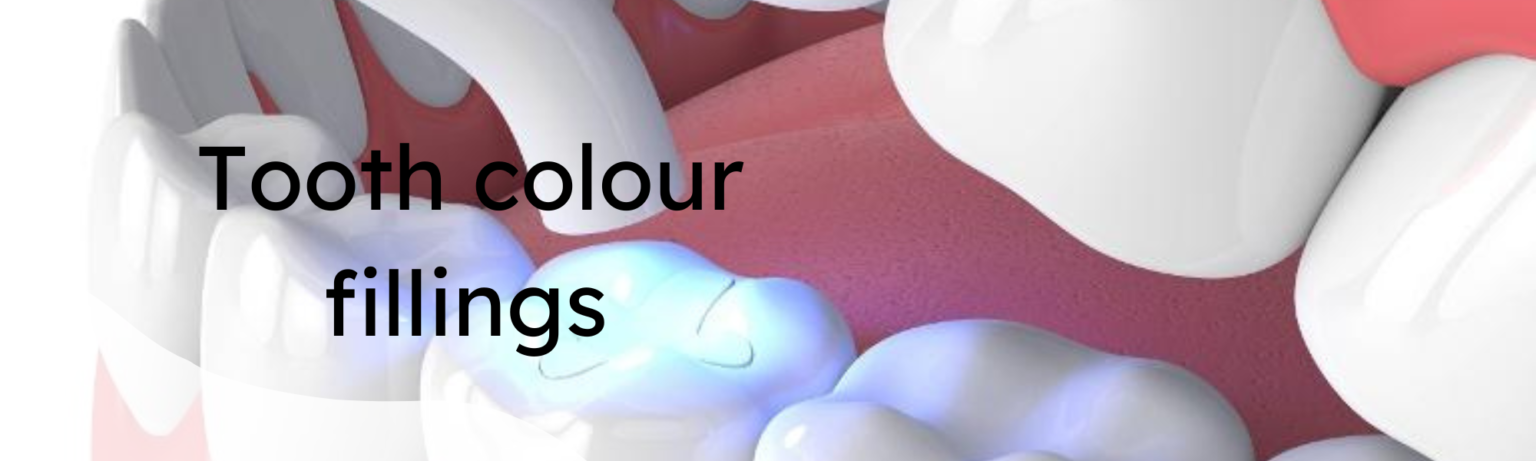 Tooth colour fillings – Cosmodent